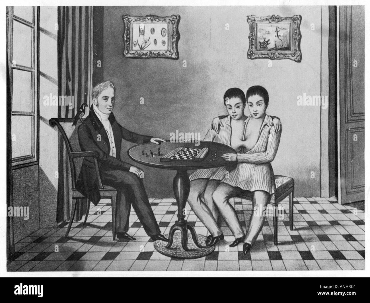 Siamese twins hi-res stock photography and images - Alamy