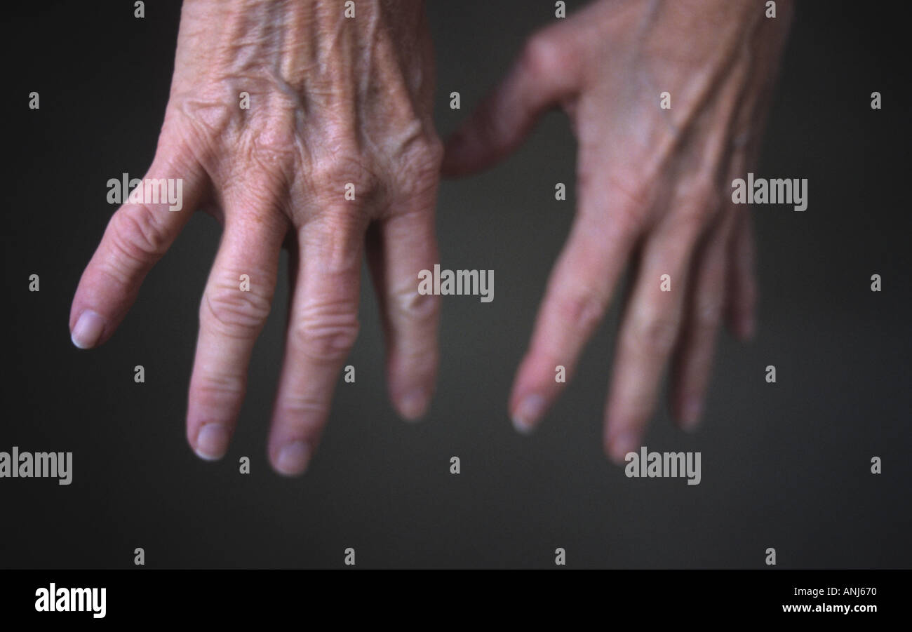 Old womans hands MODEL RELEASE Stock Photo - Alamy