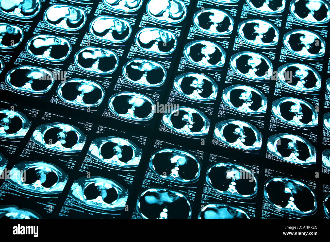 Cat scans computer hi-res stock photography and images - Alamy