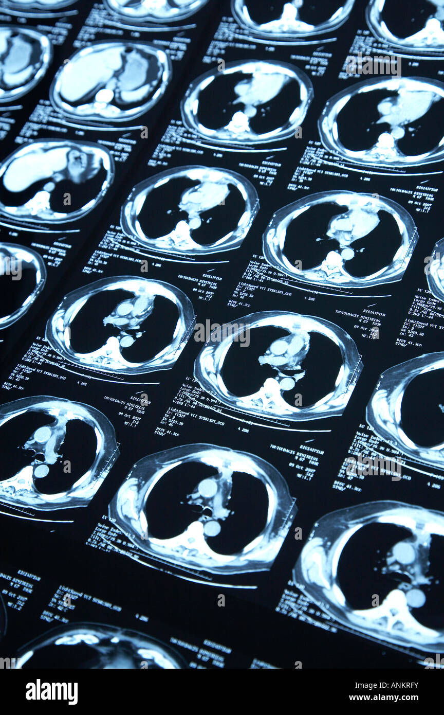 Cat scans computer hi-res stock photography and images - Alamy