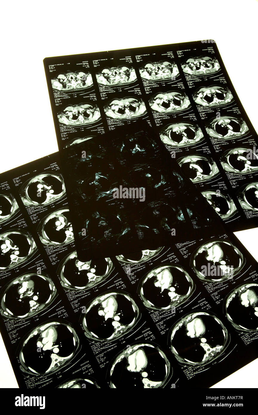 Cat health research hi-res stock photography and images - Alamy