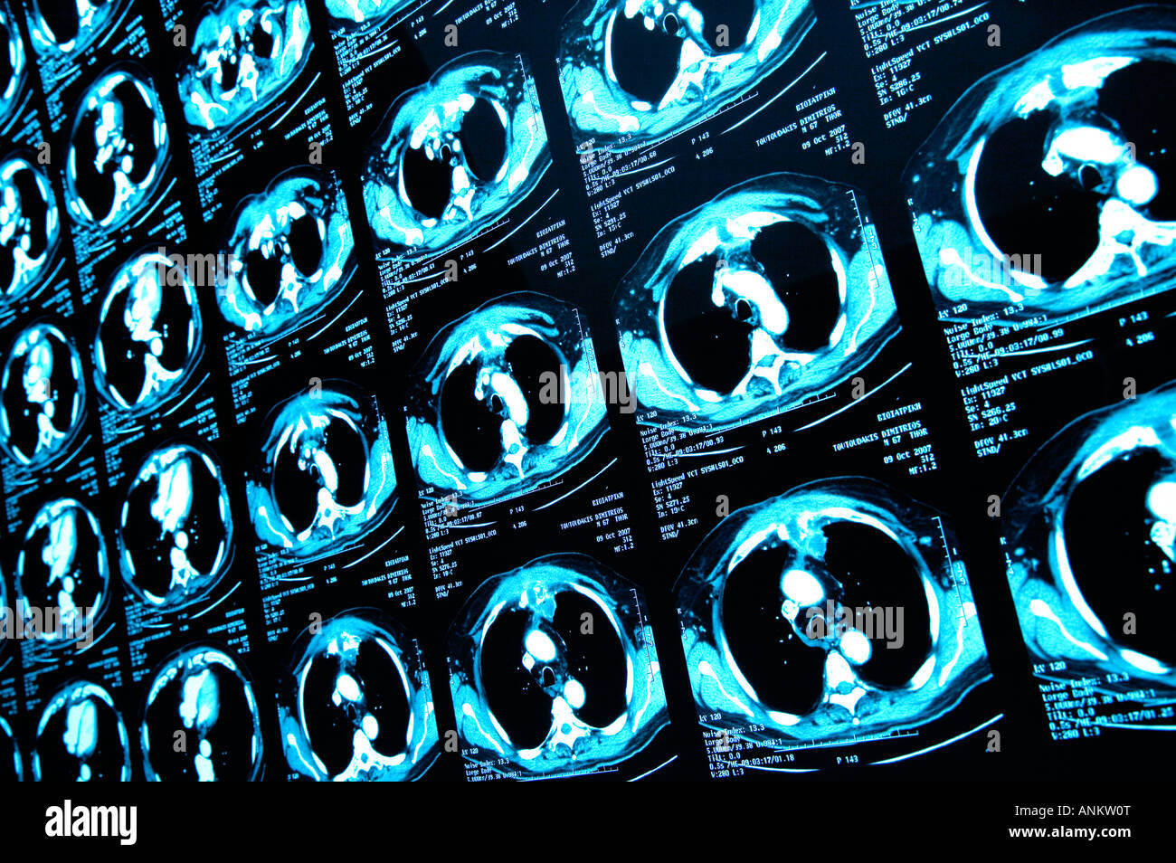 Med01167 hi-res stock photography and images - Alamy