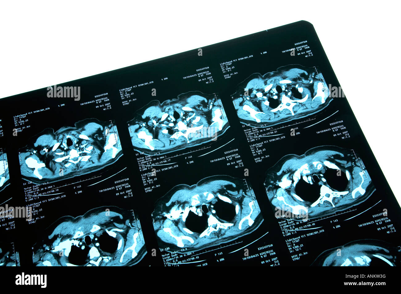 Cat scans computer hi-res stock photography and images - Alamy