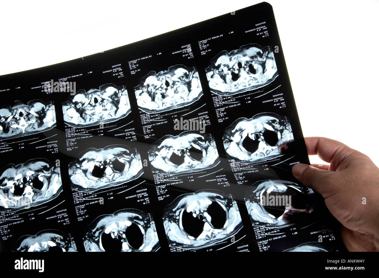 Male hand examining a cat scan Stock Photo - Alamy