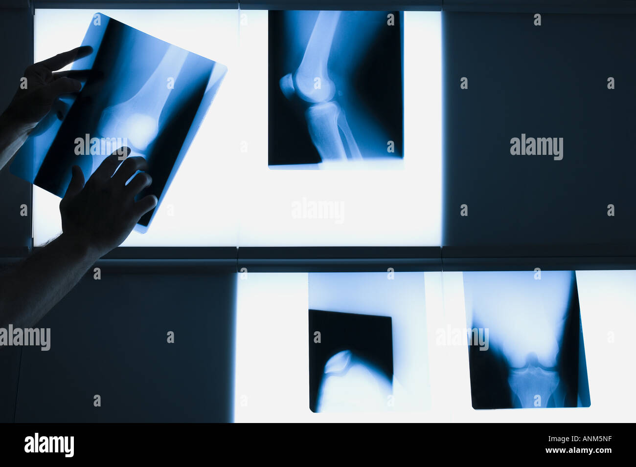 Person s hand positioning an X Ray Stock Photo - Alamy