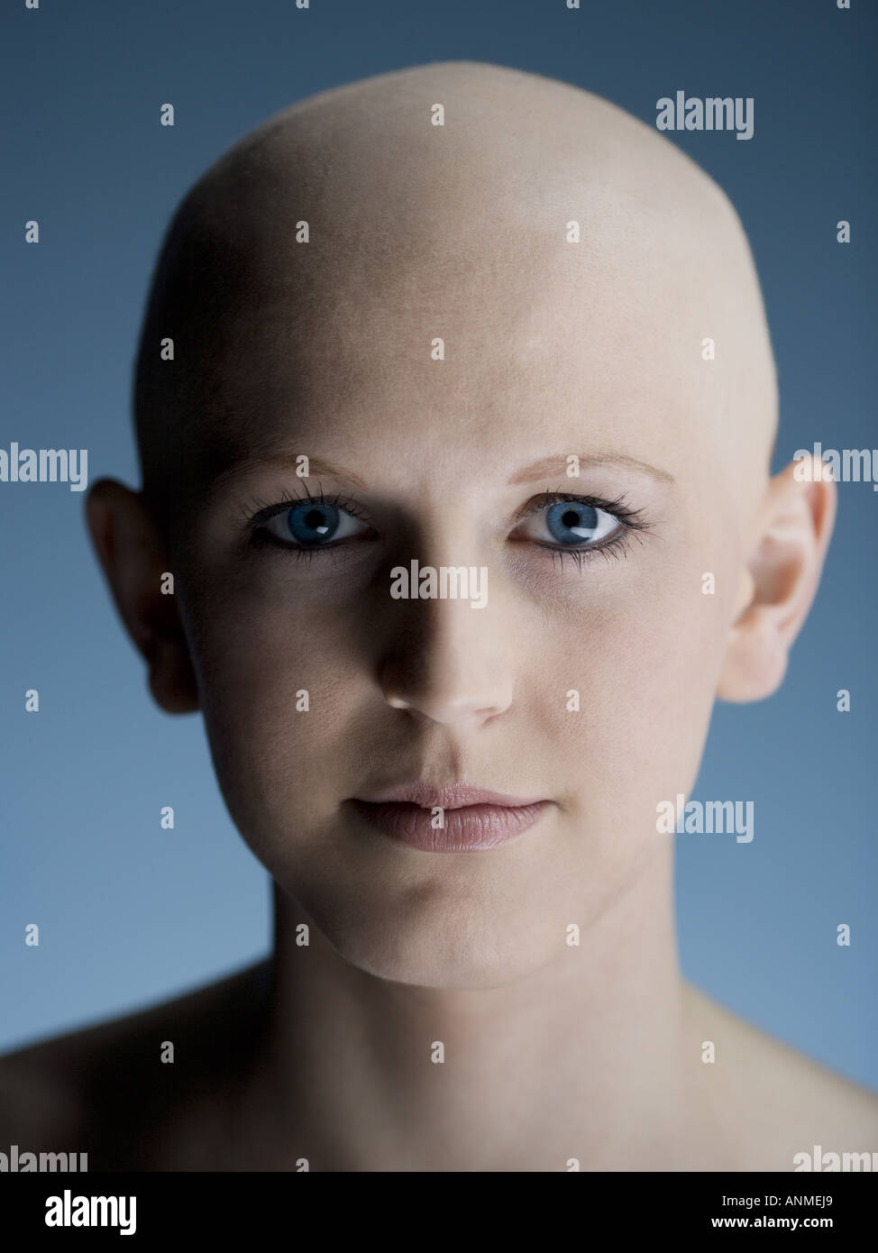 Portrait of a bald young woman Stock Photo - Alamy