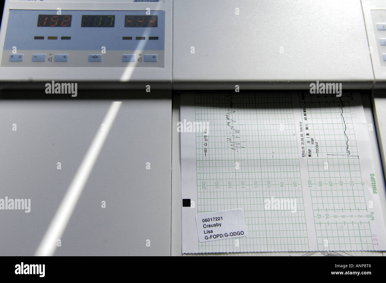 ecg electrocardiograph maternity pregnancy heart rate monitor baby ...