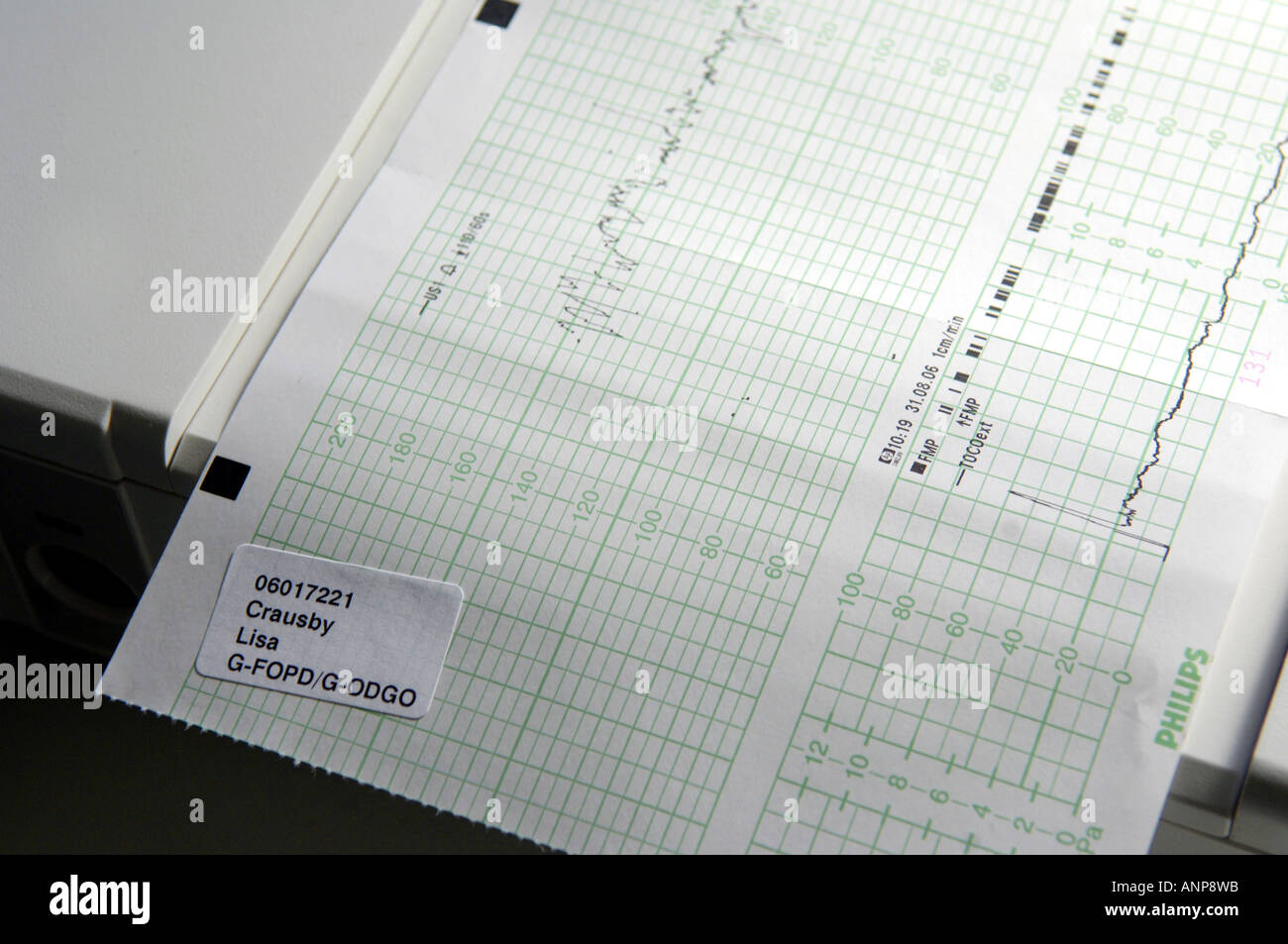 ecg electrocardiograph maternity pregnancy heart rate monitor baby ...