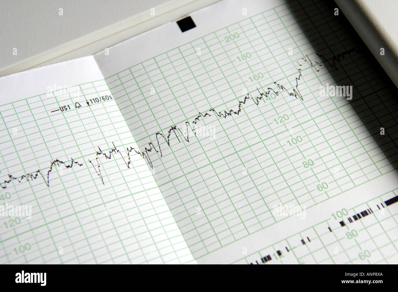 ecg electrocardiograph maternity pregnancy heart rate monitor baby ...