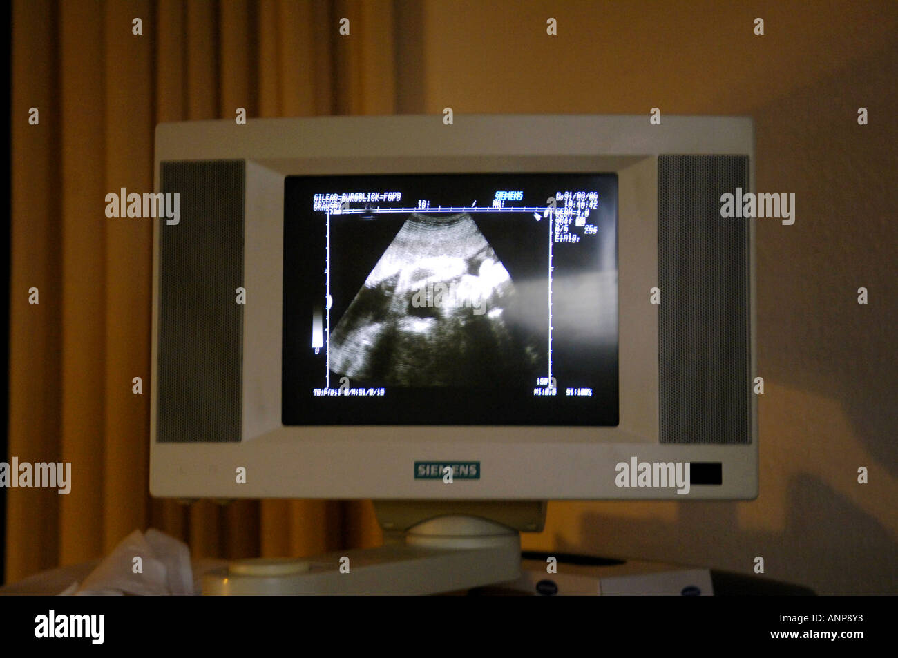 scan pregnant baby colour color pregnancy horizontal maternity monitor ...