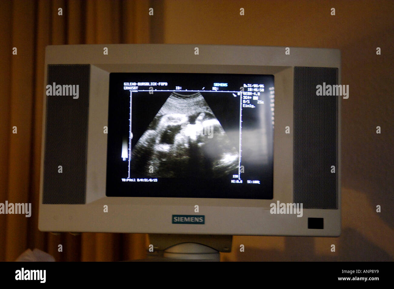 scan pregnant baby colour color pregnancy horizontal maternity monitor ...