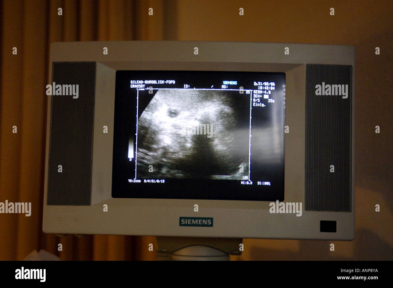 scan pregnant baby colour color pregnancy horizontal Stock Photo - Alamy