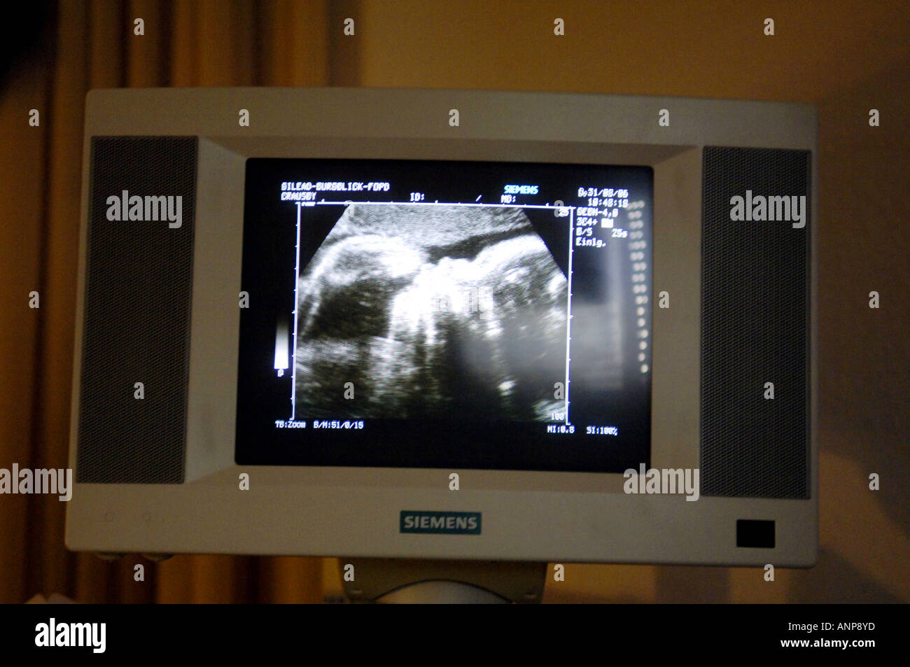 scan pregnant baby colour color pregnancy horizontal Stock Photo - Alamy