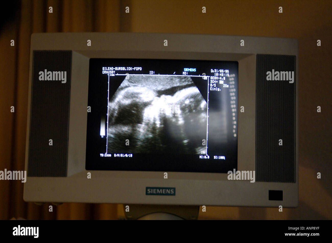 scan pregnant baby colour color pregnancy horizontal Stock Photo - Alamy