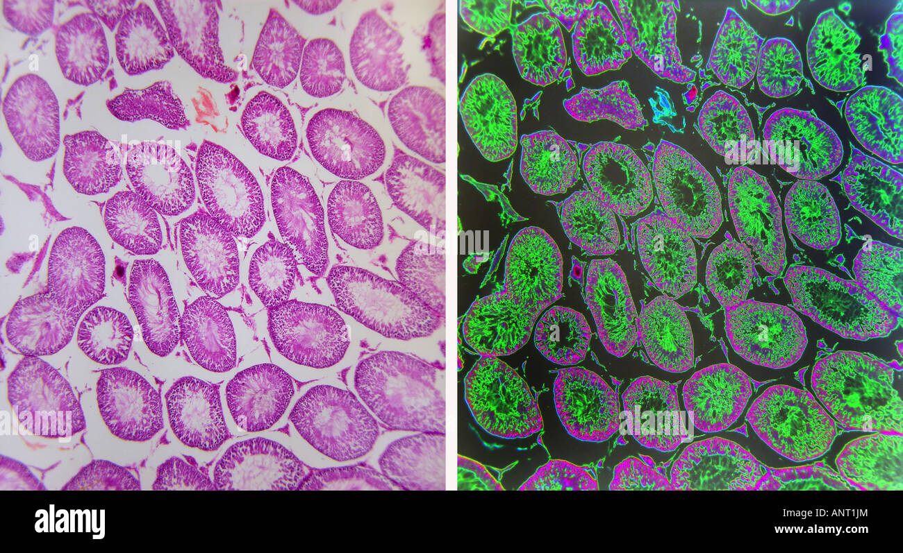Testis hi-res stock photography and images - Alamy