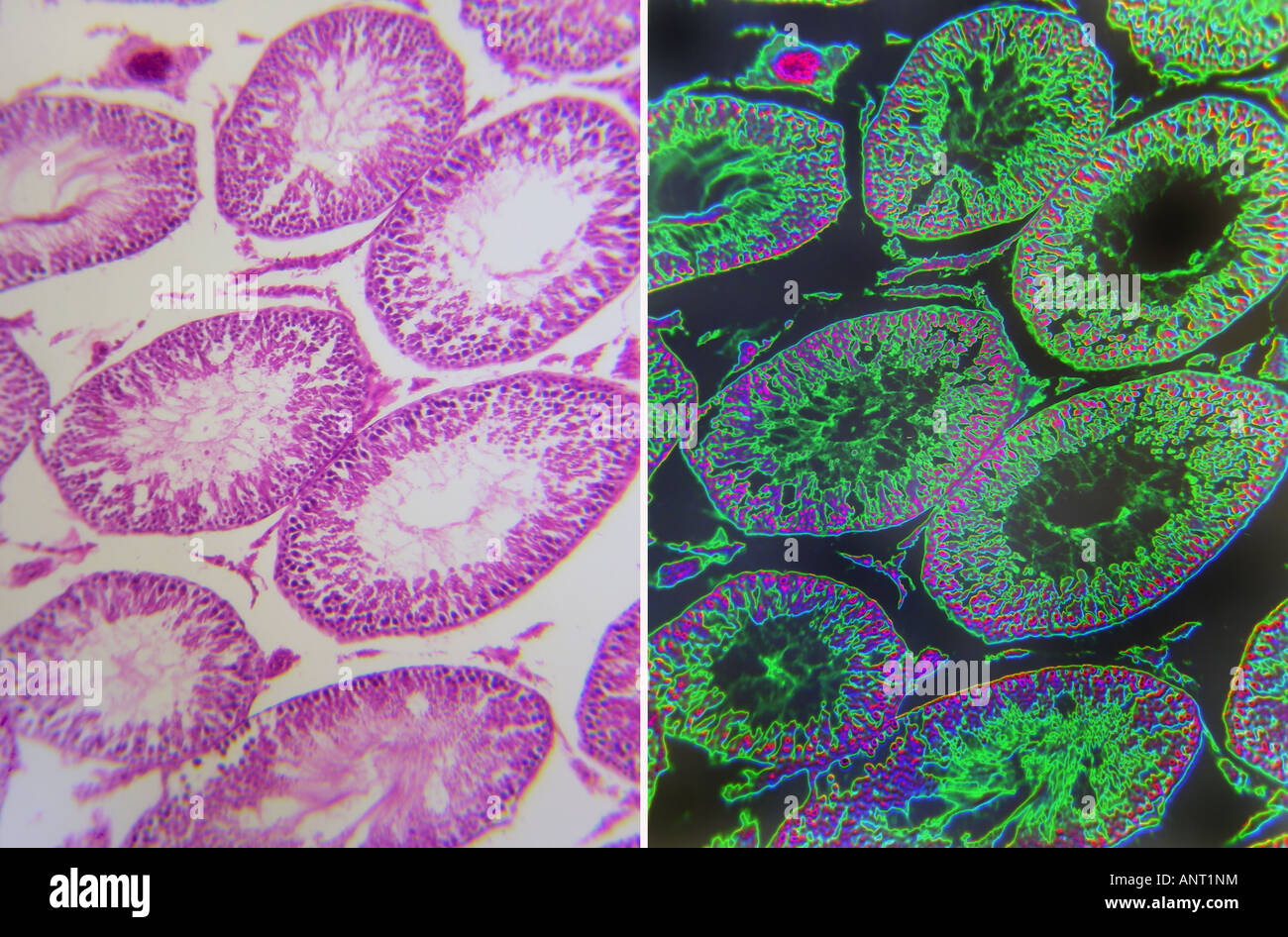 Testis High Resolution Stock Photography and Images - Alamy