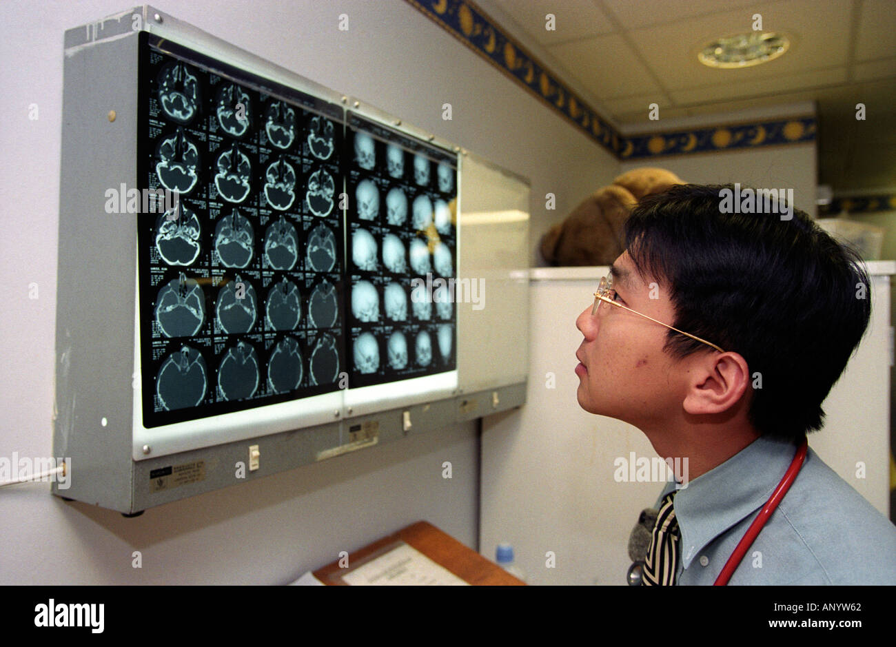 Diagnosis x ray nhs doctor hi-res stock photography and images - Alamy