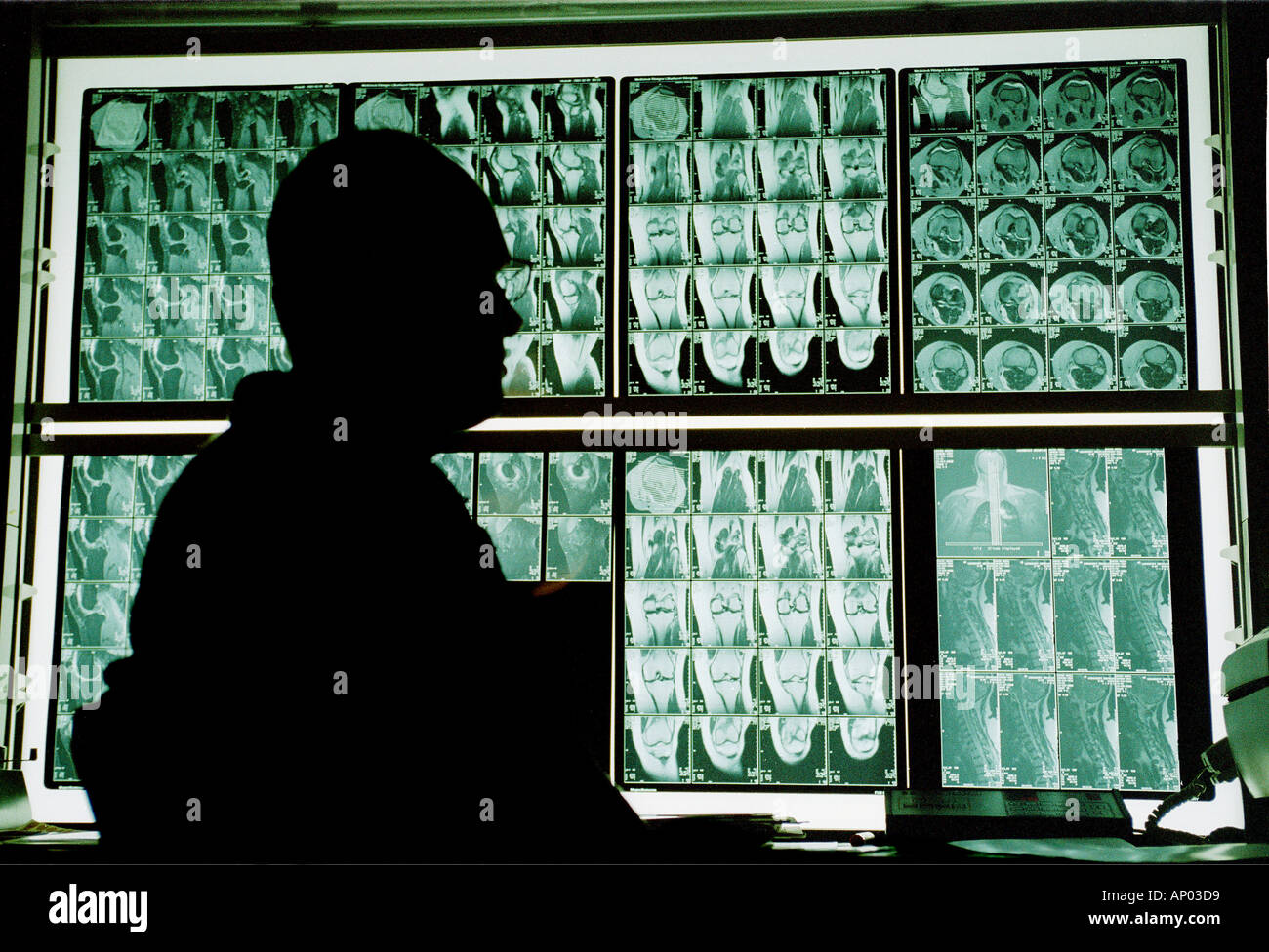 Wall of xrays from a MRI camera at clinic Stock Photo - Alamy
