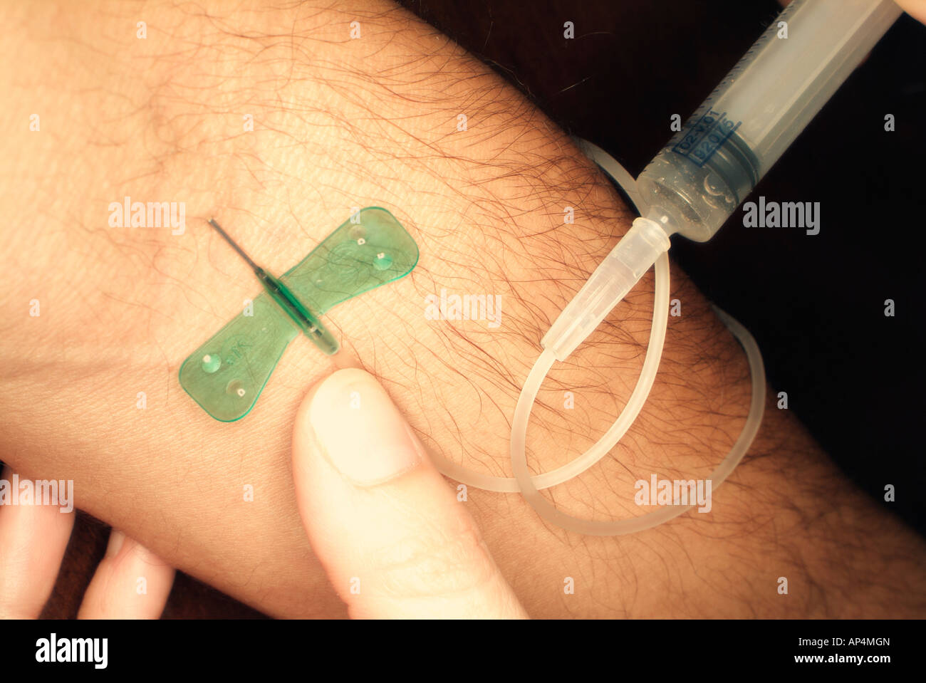 Catheterisation hi-res stock photography and images - Alamy