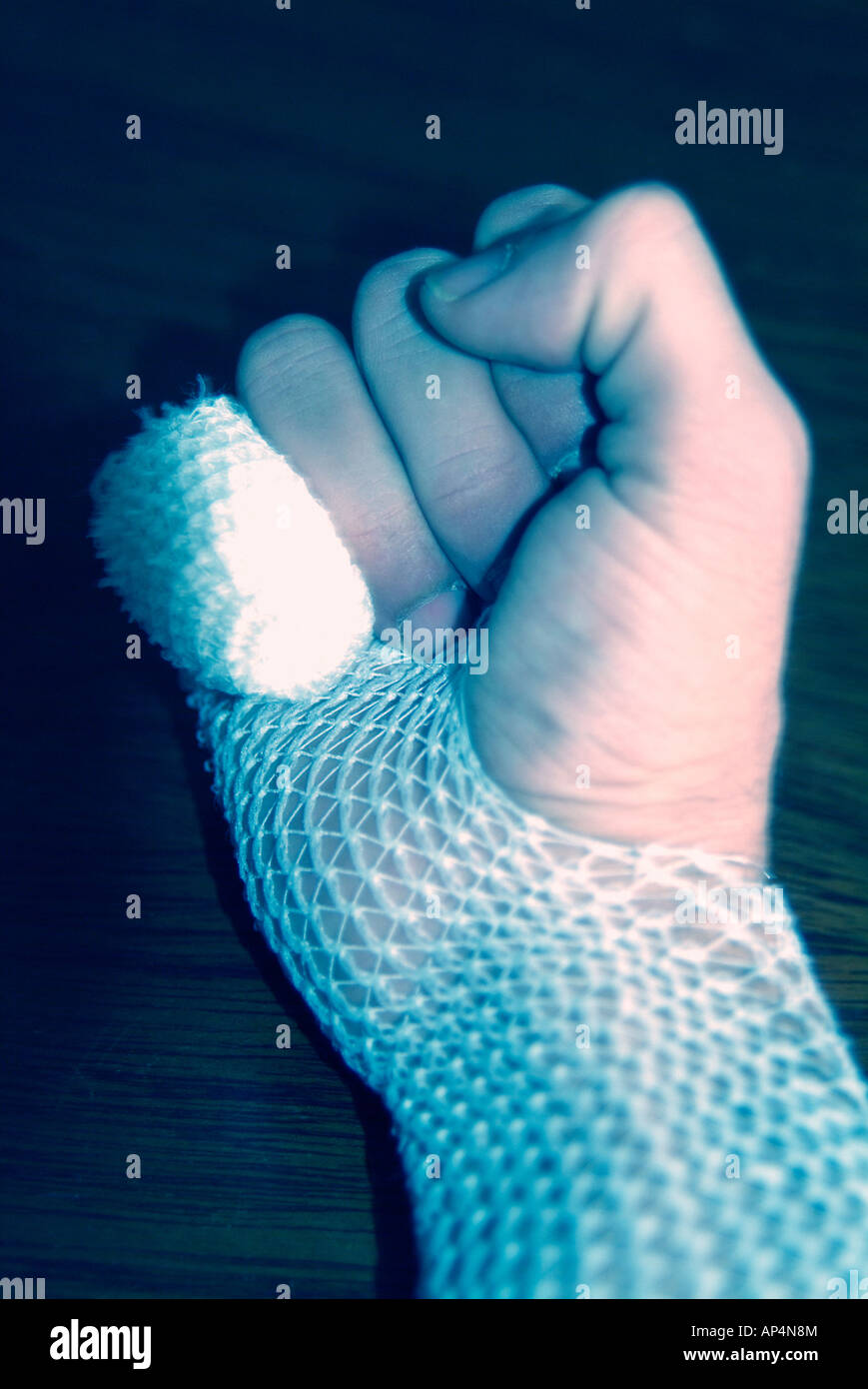 Wounded hand bandaged in artificial colours Stock Photo - Alamy