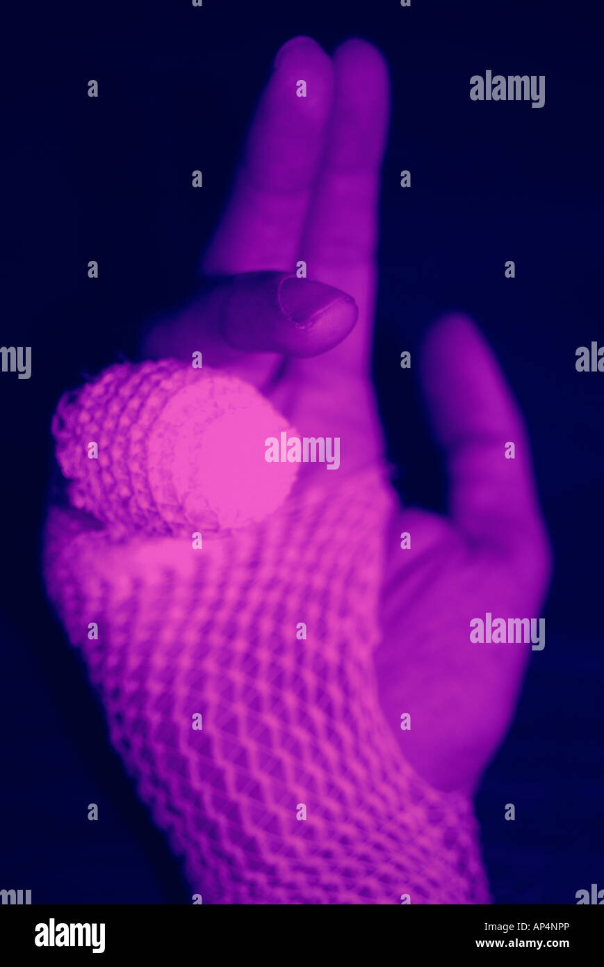 Wounded hand bandaged under purple light Stock Photo - Alamy