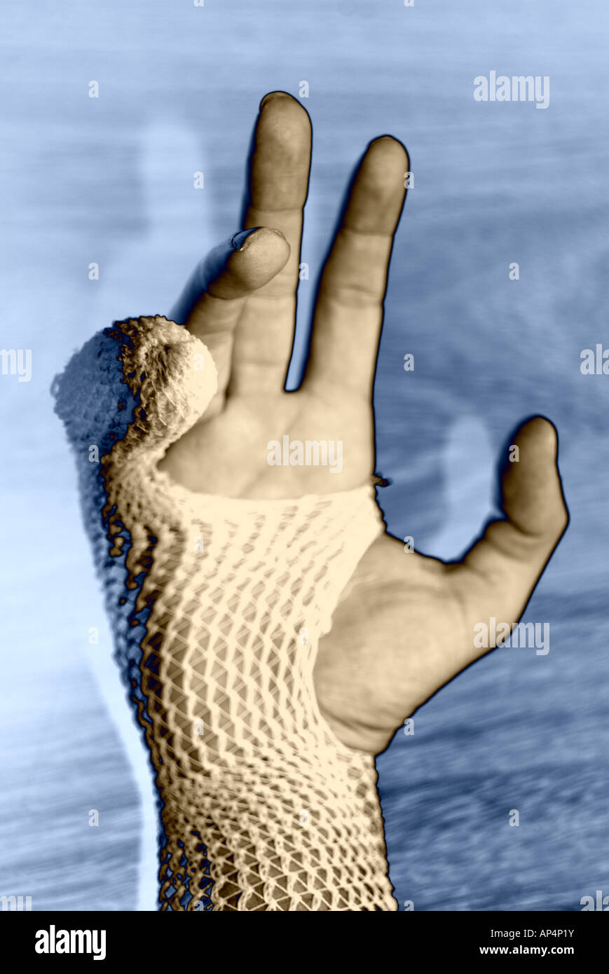 Wounded hand bandaged in artificial colours Stock Photo - Alamy