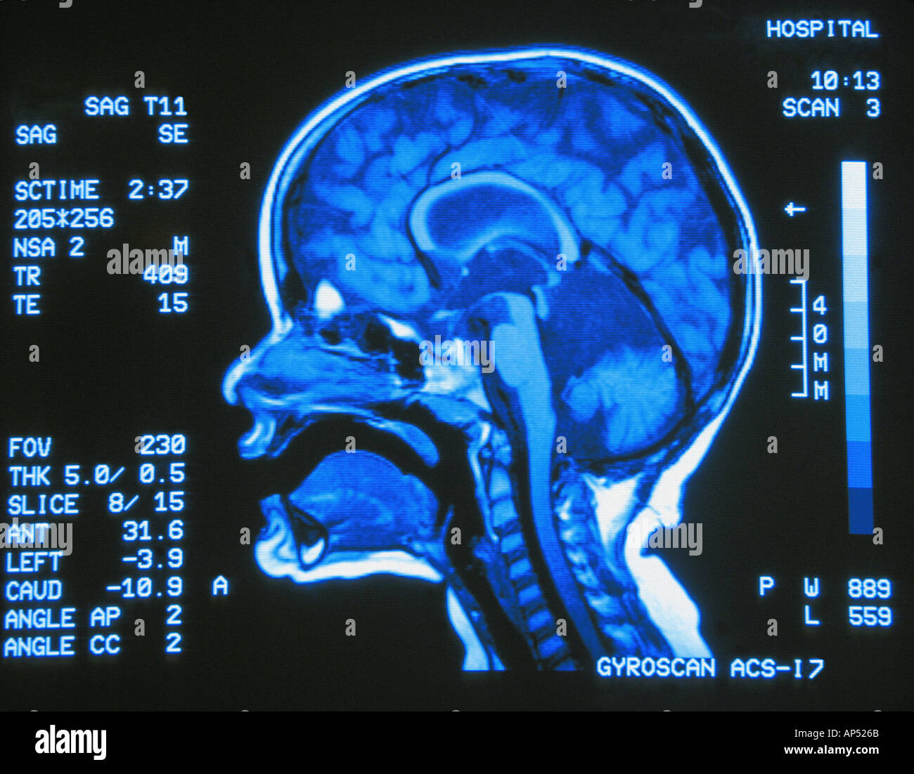Brain illustration all angles hi-res stock photography and images - Alamy