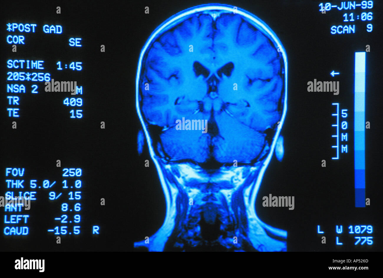 Brain illustration angles hi-res stock photography and images - Alamy