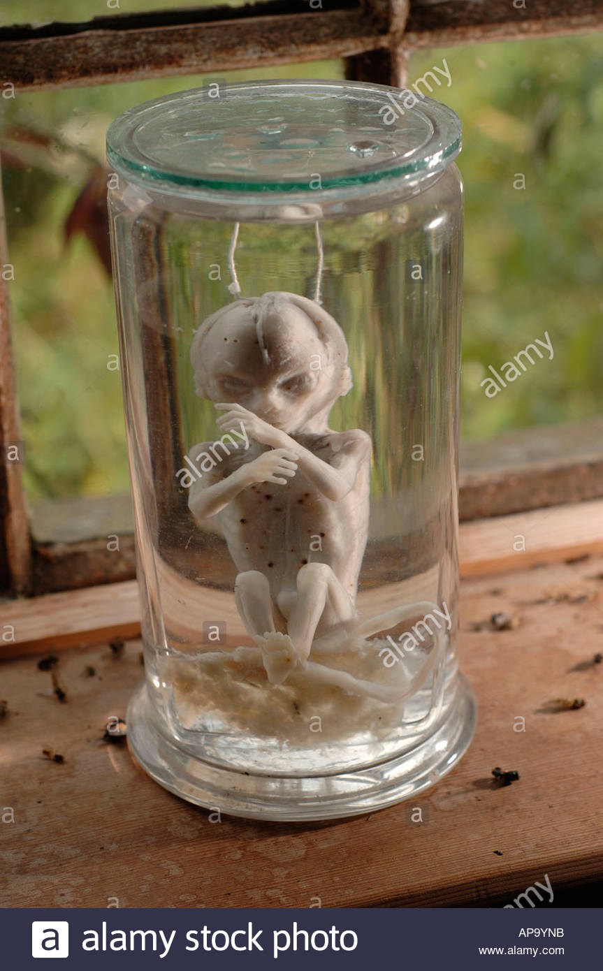 Human Foetus Stock Photos & Human Foetus Stock Images - Alamy