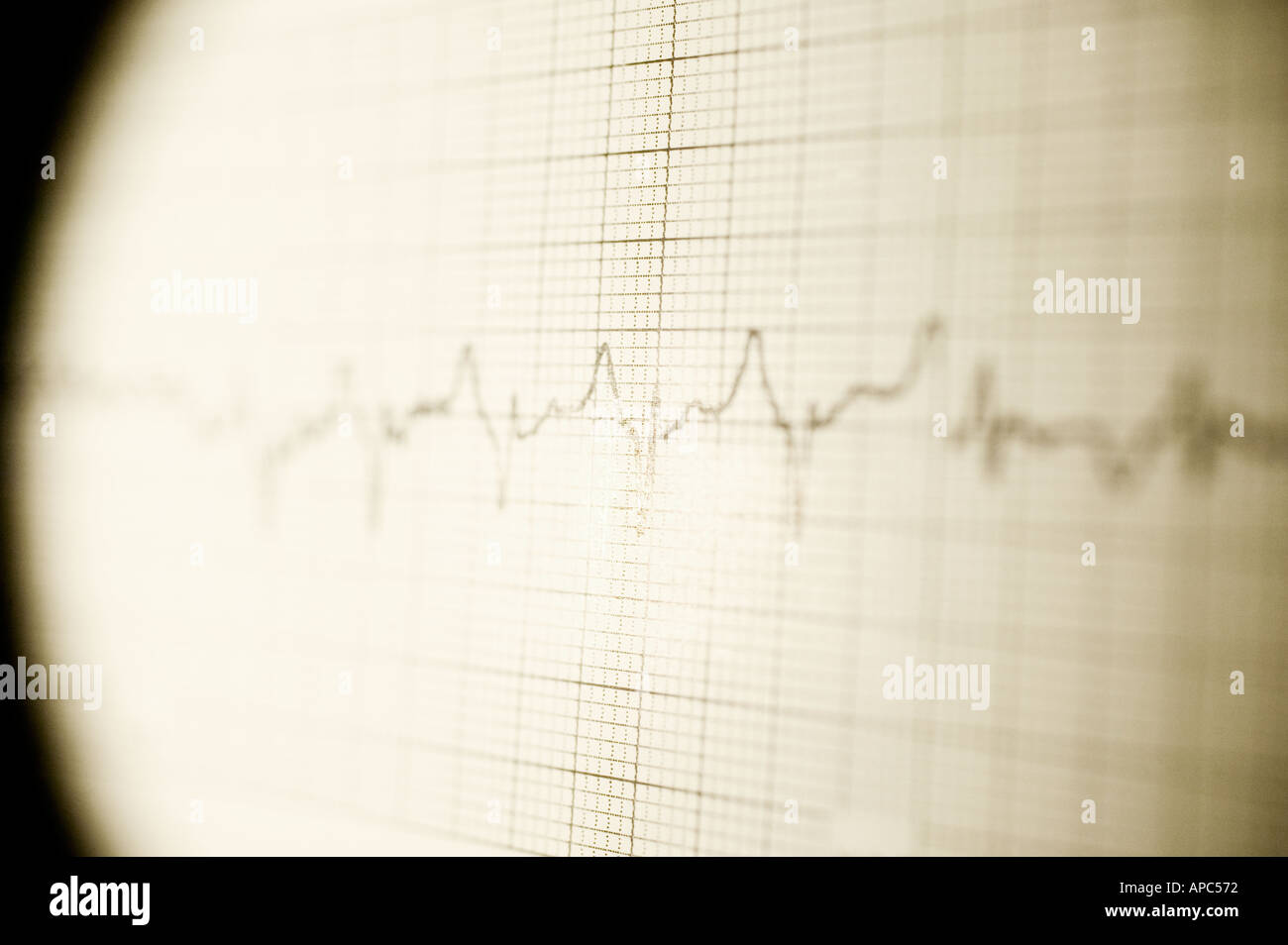 Heart EKG Print Amber Stock Photo - Alamy
