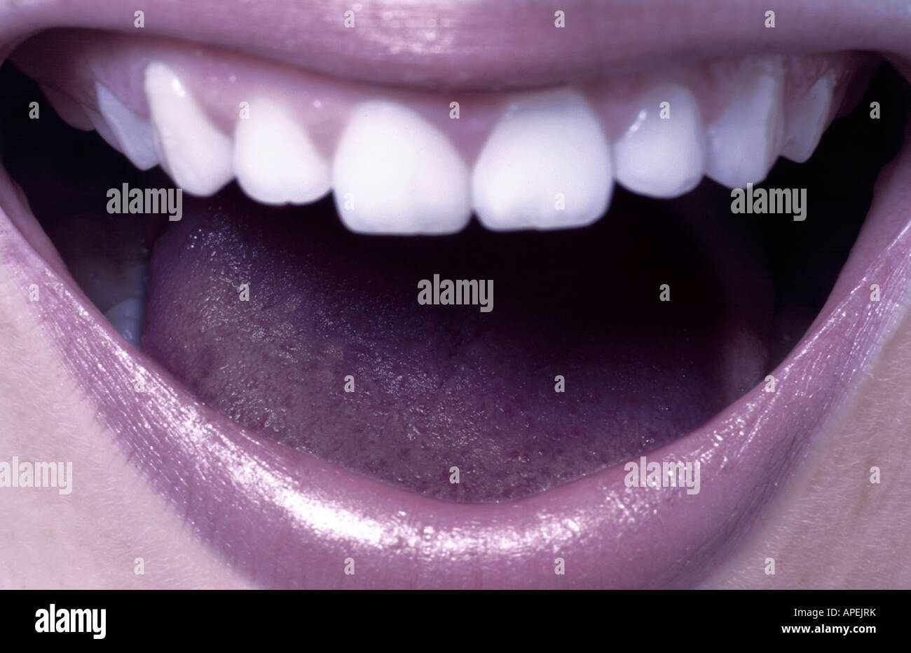 Close up of mouth and teeth Stock Photo - Alamy