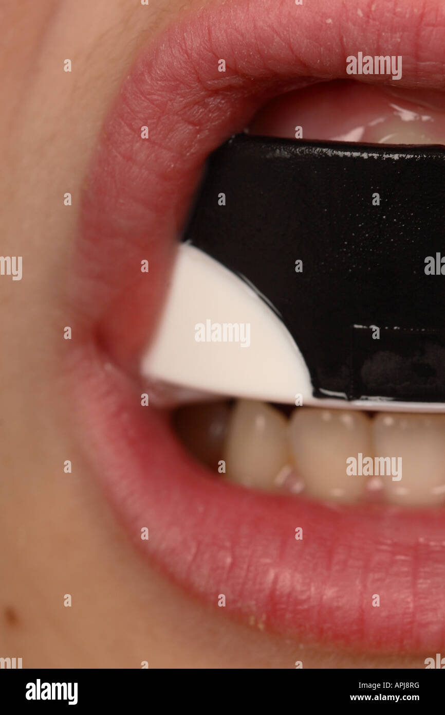 Sports Gum guard in the mouth of a teenage sports player Stock Photo ...