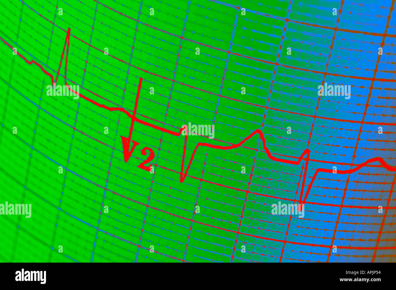Ekg cardiac arrest hi-res stock photography and images - Alamy