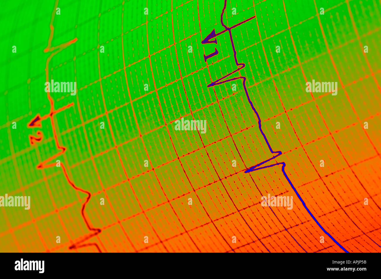 Ekg electrocardiogram closeup view concept hi-res stock photography and ...