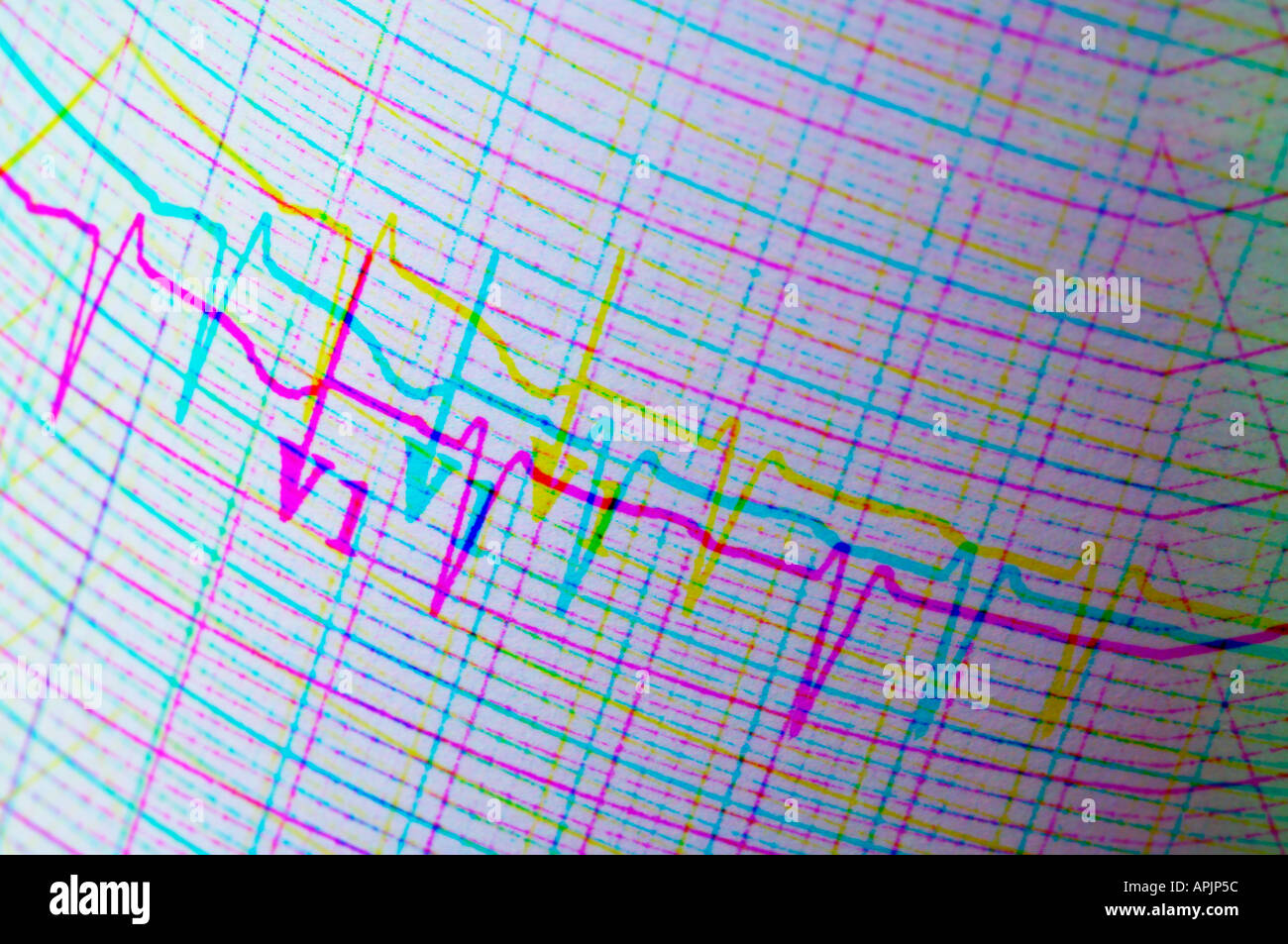 EKG electrocardiogram closeup view concept Stock Photo - Alamy