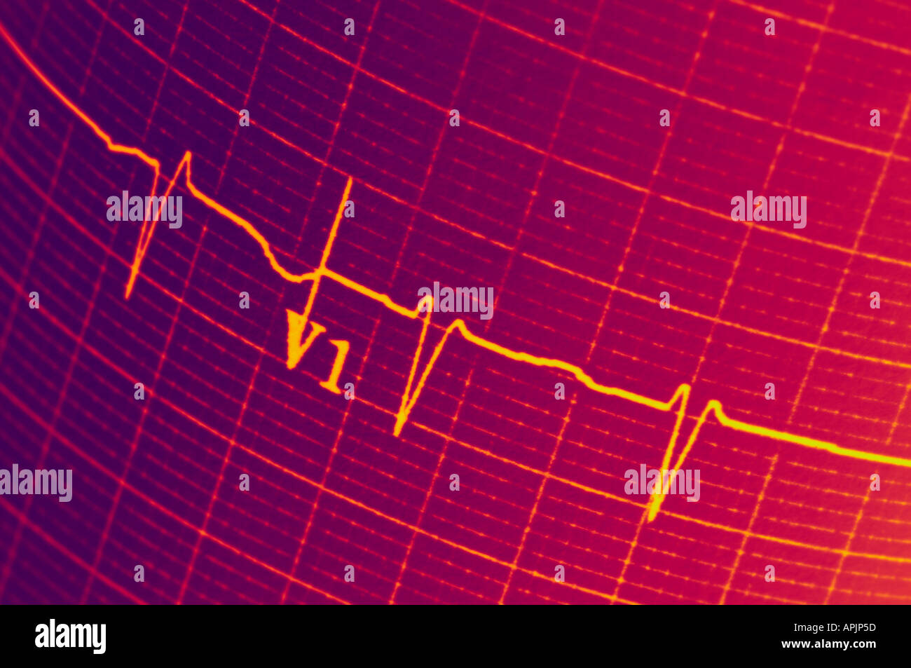 Ekg electrocardiogram closeup view concept hi-res stock photography and ...