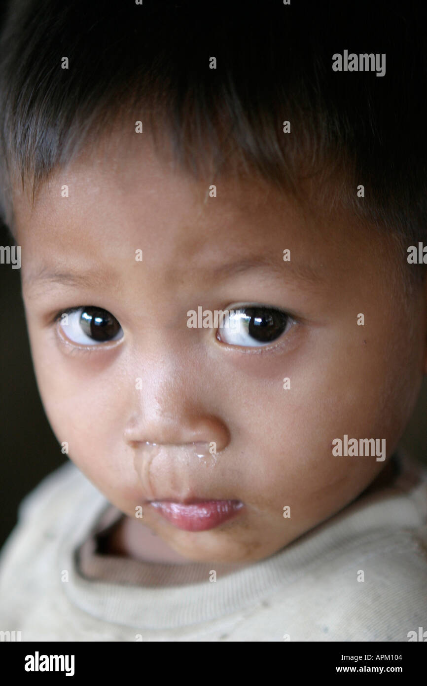 Snotty nose hi-res stock photography and images - Alamy