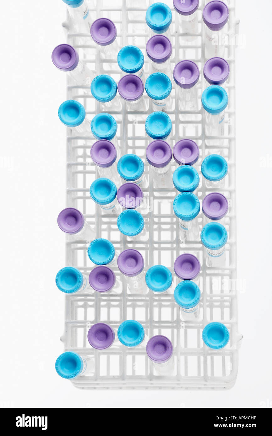 Test tubes in rack (directly above Stock Photo - Alamy