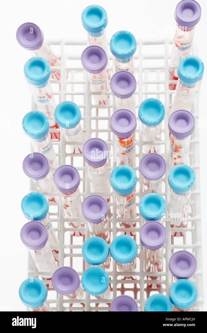 Blood samples in test tubes (close-up Stock Photo - Alamy