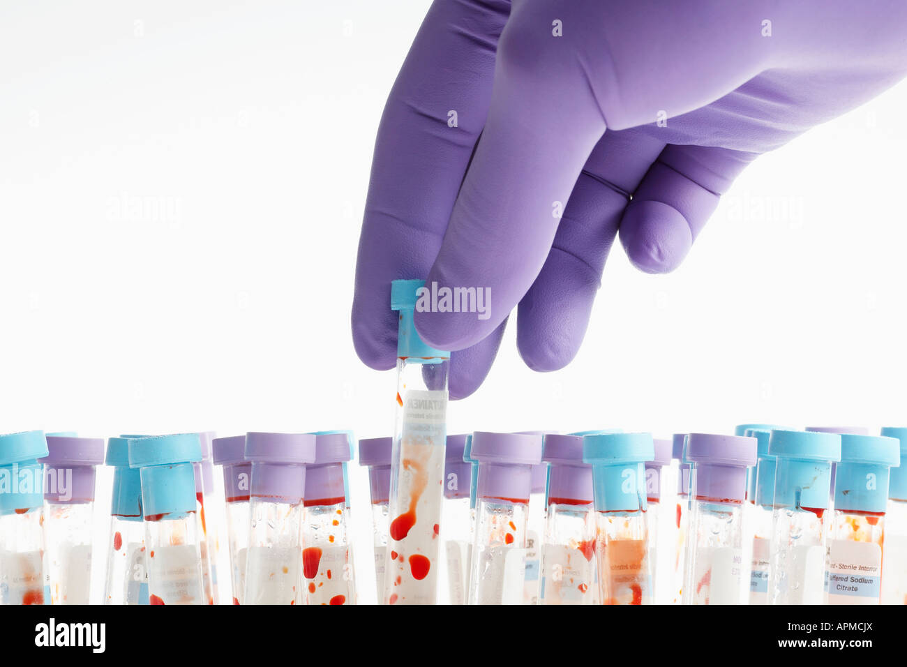 Hand holding blood sample in test tube (close-up Stock Photo - Alamy