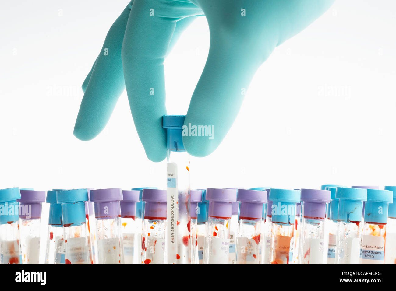 Hand holding blood sample in test tube (close-up Stock Photo - Alamy
