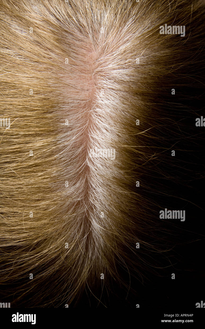 Hair roots showing hi-res stock photography and images - Alamy