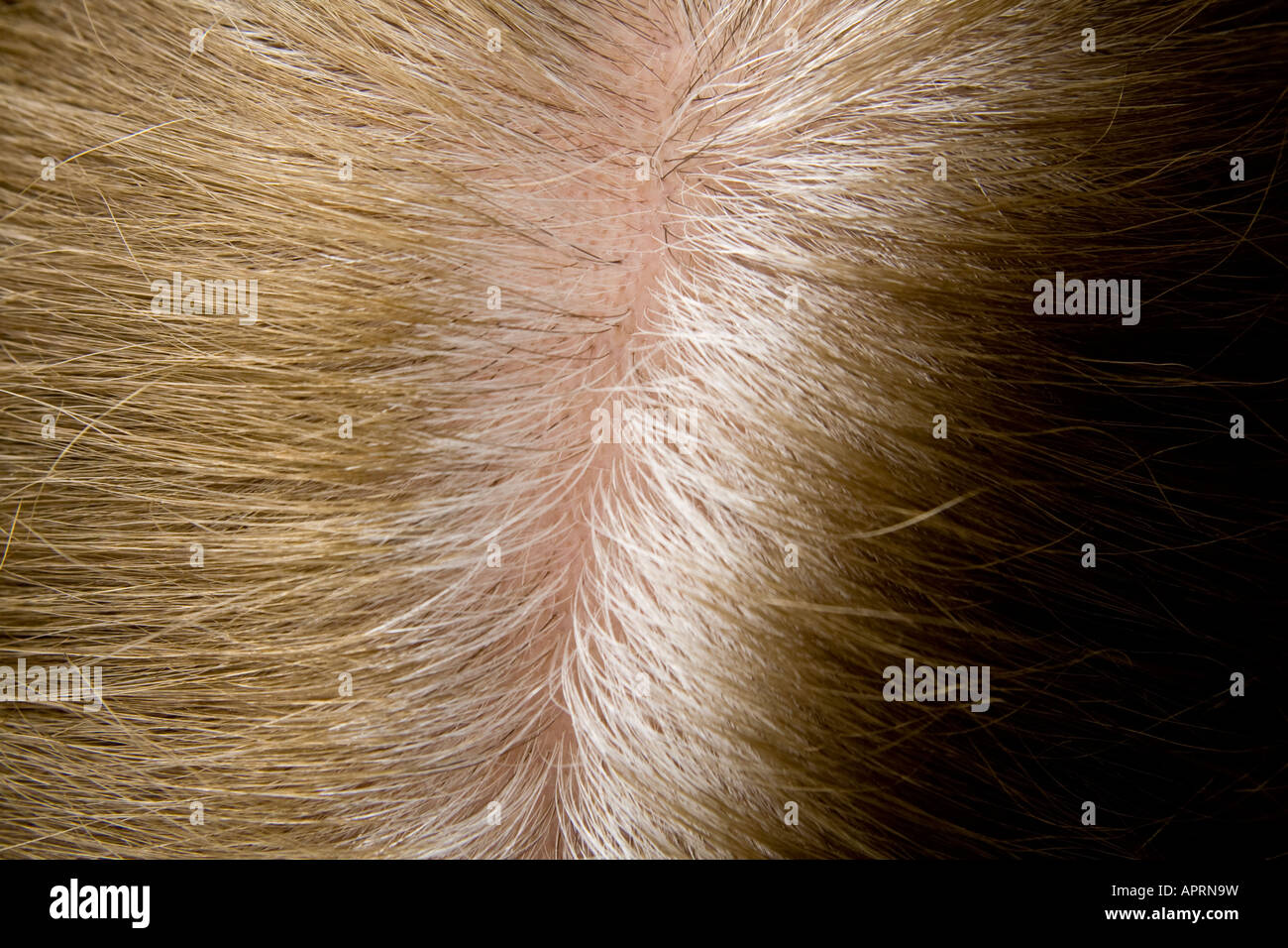 Hair roots showing hi-res stock photography and images - Alamy