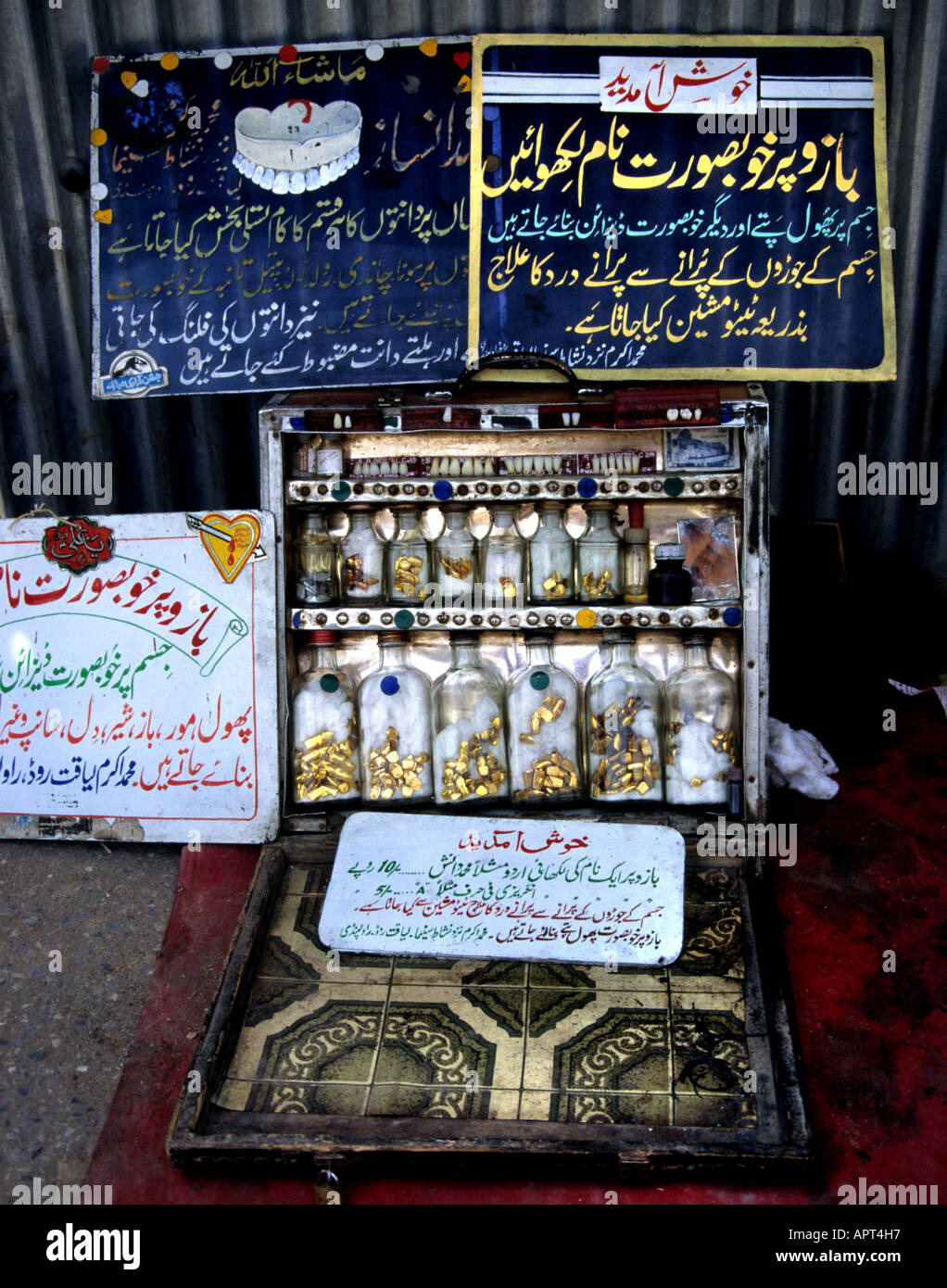 Gold Tooth High Resolution Stock Photography and Images - Alamy