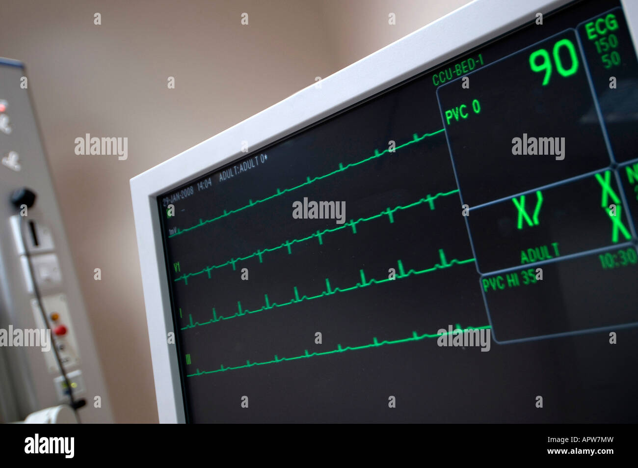 Heart Monitor, UK Hospital Stock Photo - Alamy