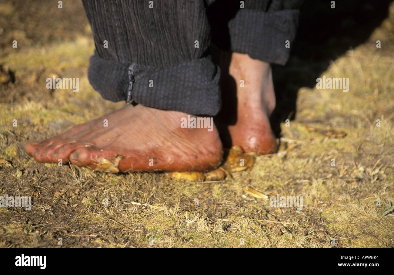 One of the production stages of white chuño: The trampling of the ...