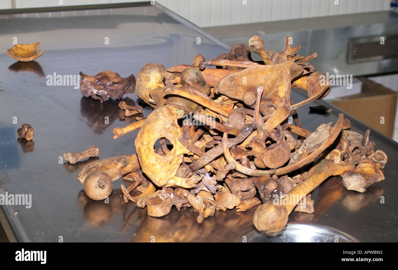 Reassembling exhumed human skeleton in laboratory Stock Photo - Alamy