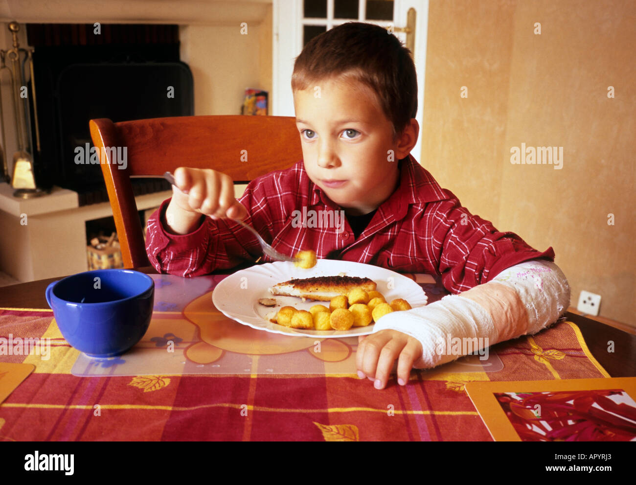 Boy with broken arm in gipsum plastern eating Stock Photo - Alamy