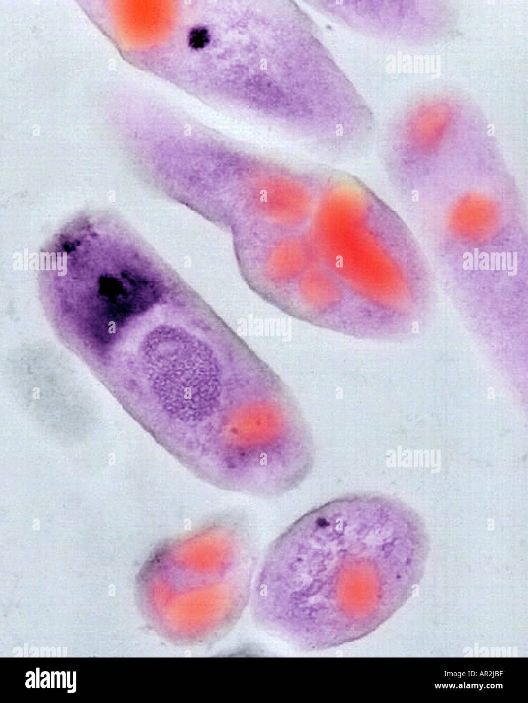 Electron microscope image of bacteria hi-res stock photography and ...