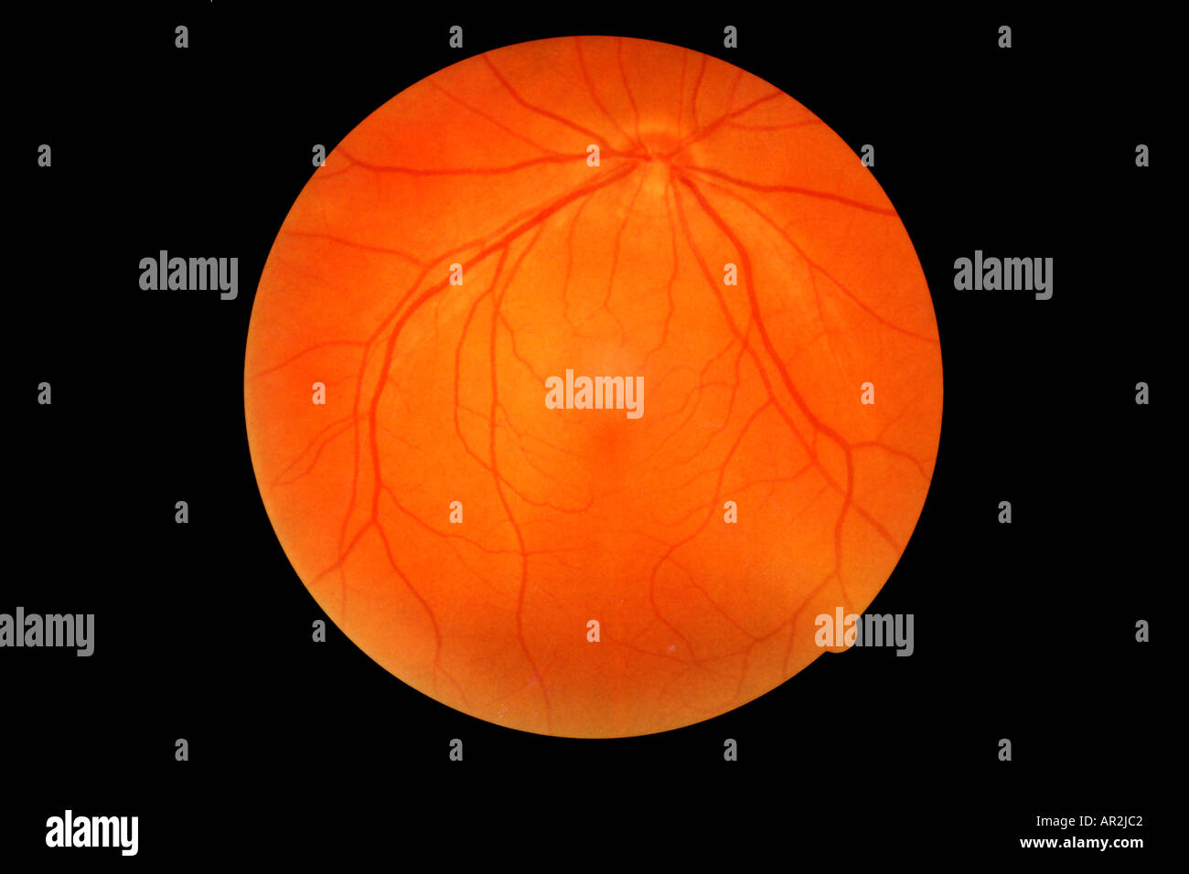 Normal arteries hi-res stock photography and images - Alamy